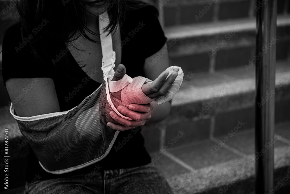 A beautiful Asian girl broke her arm and splinted,Woman accidentally ...