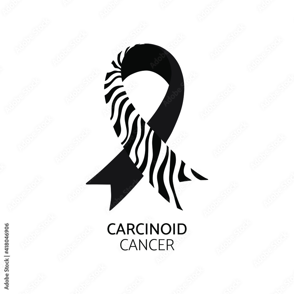 Carcinoid cancer awareness symbol. Zebra print ribbon, vector ...