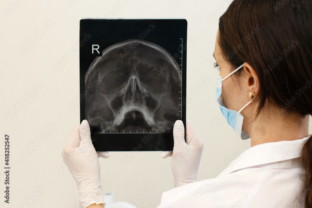 x-ray of the maxillary sinuses Stock Photo | Adobe Stock