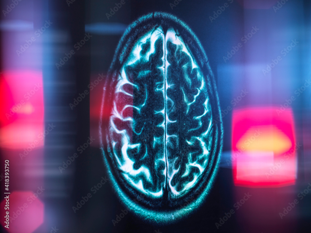 Refection of MRI brain scan on monitor display Stock Photo | Adobe Stock