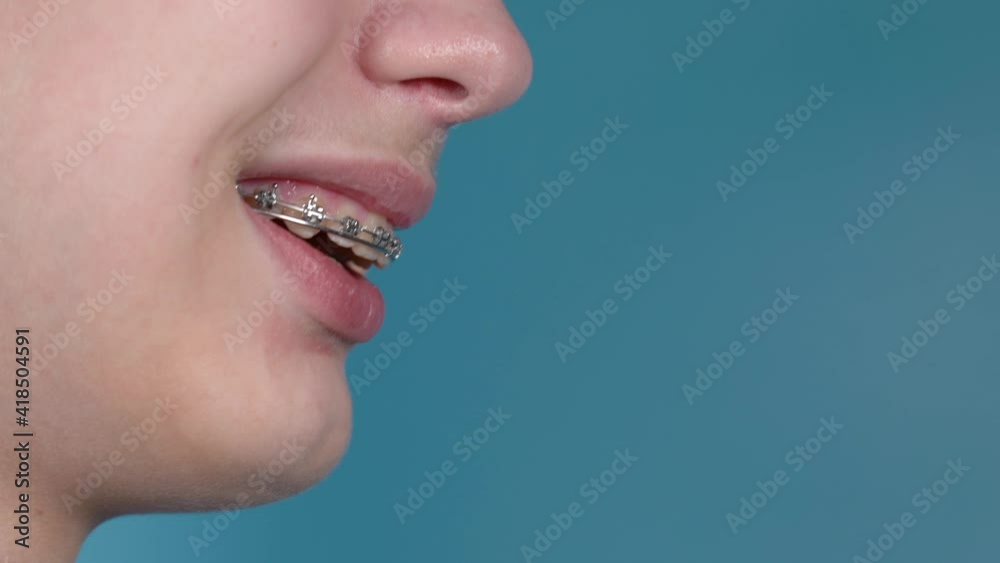 Closeup view 4k stock video footage of frofile view of smiling mouth of ...