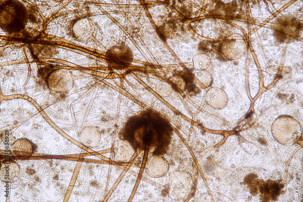 Characteristics of Rhizopus is a genus of common saprophytic fungi on ...