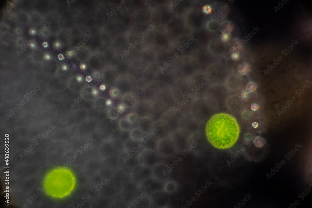 Volvox in drop of water under the microscope for classroom education ...