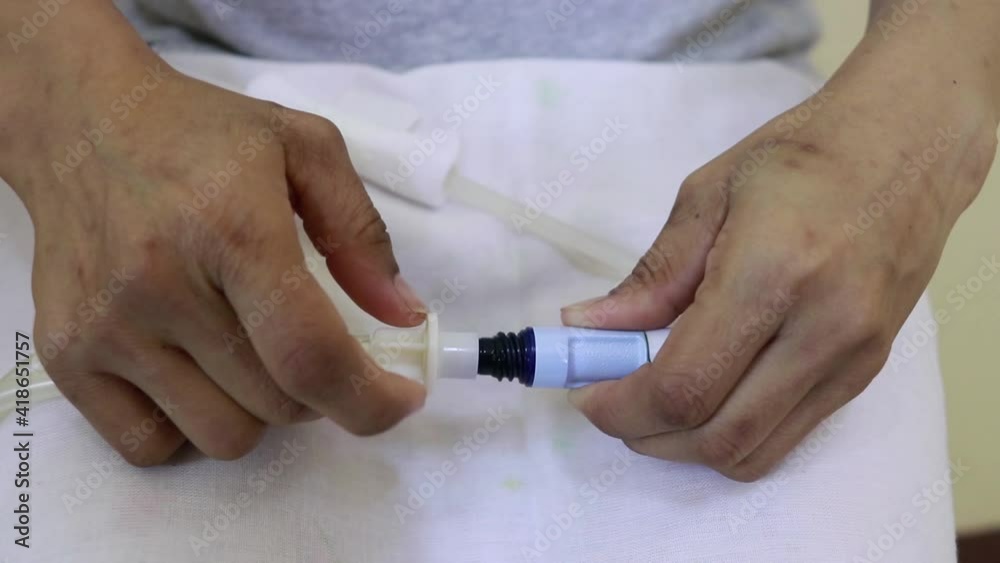 Install the peritoneal dialysis fluid bag to the tube that is connected ...