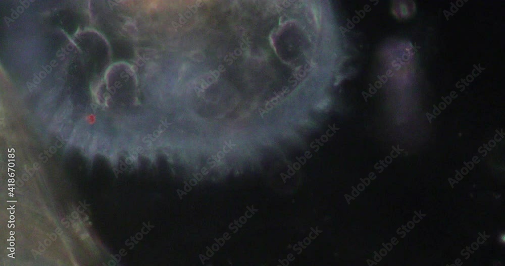 The rotifers commonly called wheel animals or wheel animalcules, make ...