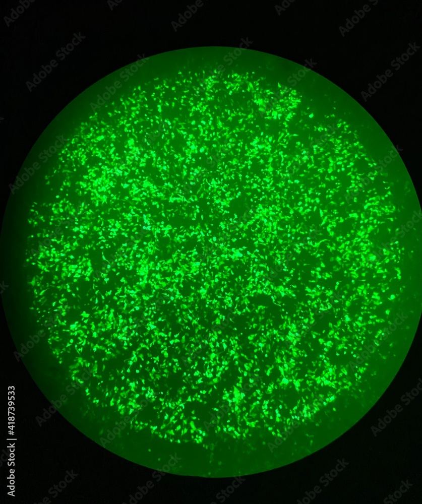 Cell transfection and expression of plasmid DNA encoding green ...