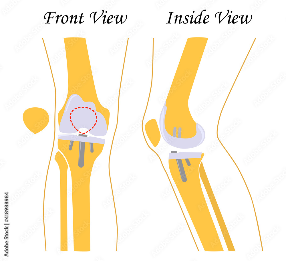 Human knee leg front and back view. Vector illustration. Flat design ...