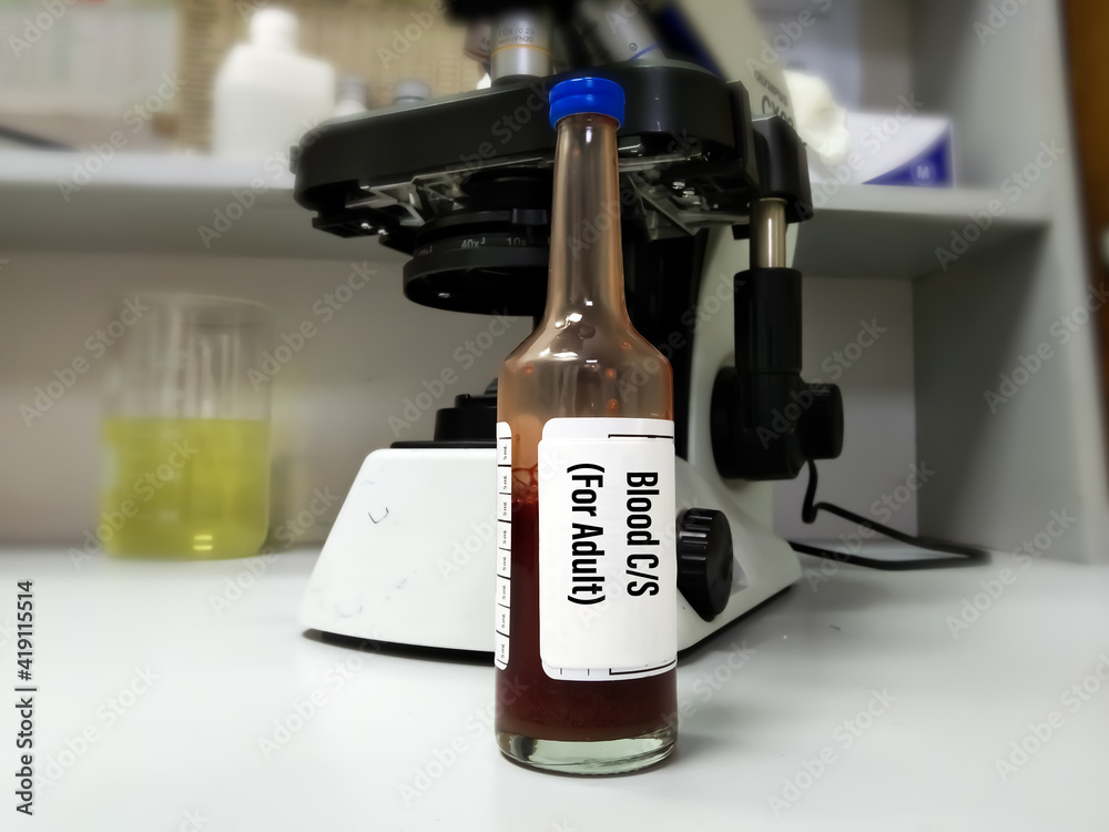 Culture bottles containing liquid media and human blood. For adult and ...