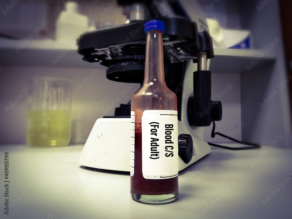 Culture bottles containing liquid media and human blood. For adult and ...