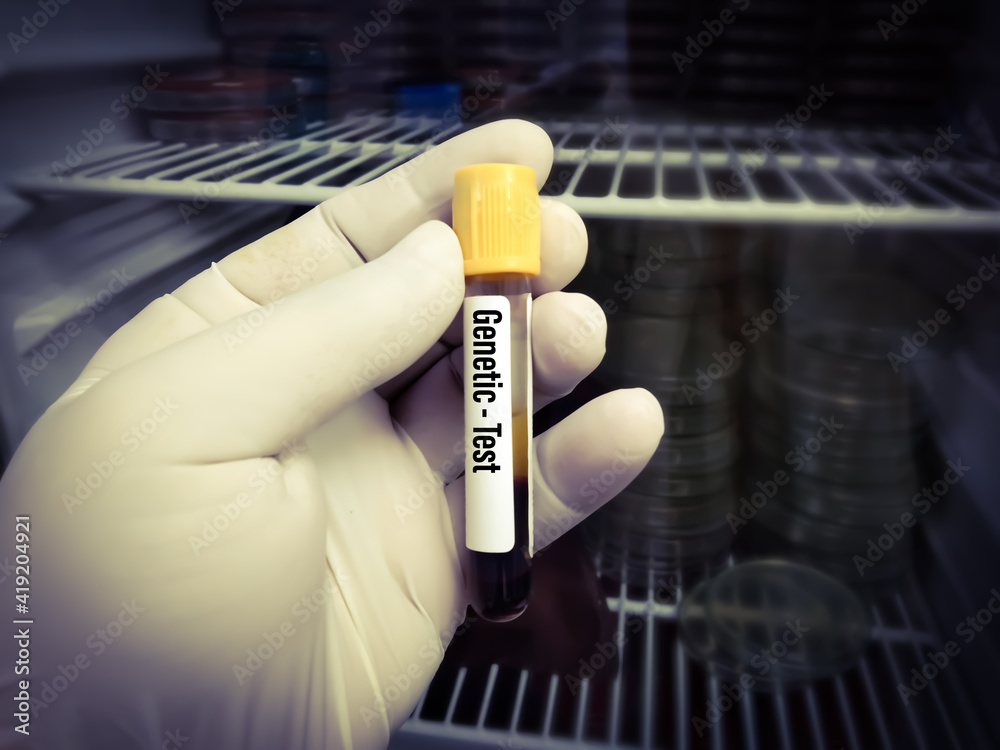 Genetic testing is a type of medical test that identifies changes in ...