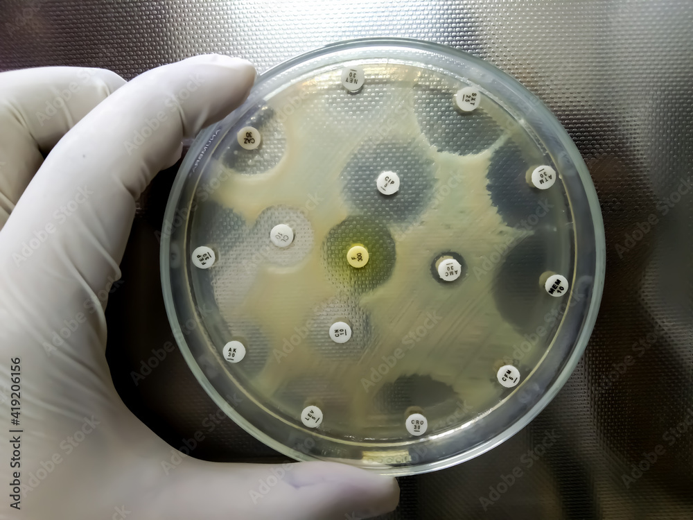 Antibiotic disk/disk drug ready for diagnosis antimicrobial ...