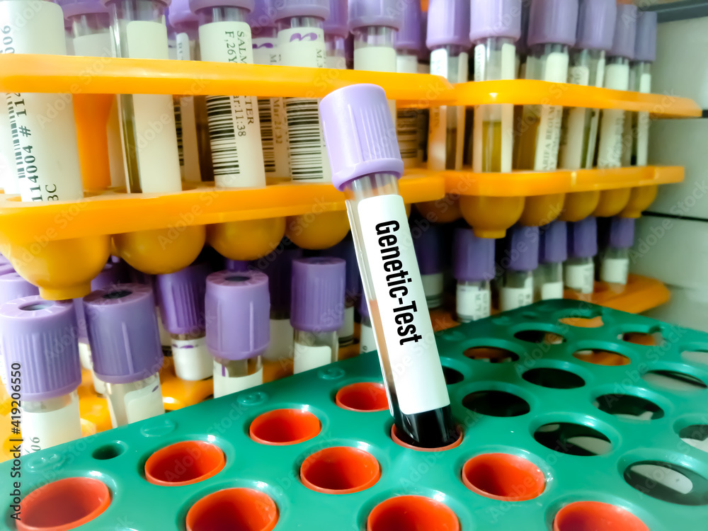 Foto de Genetic testing is a type of medical test that identifies ...