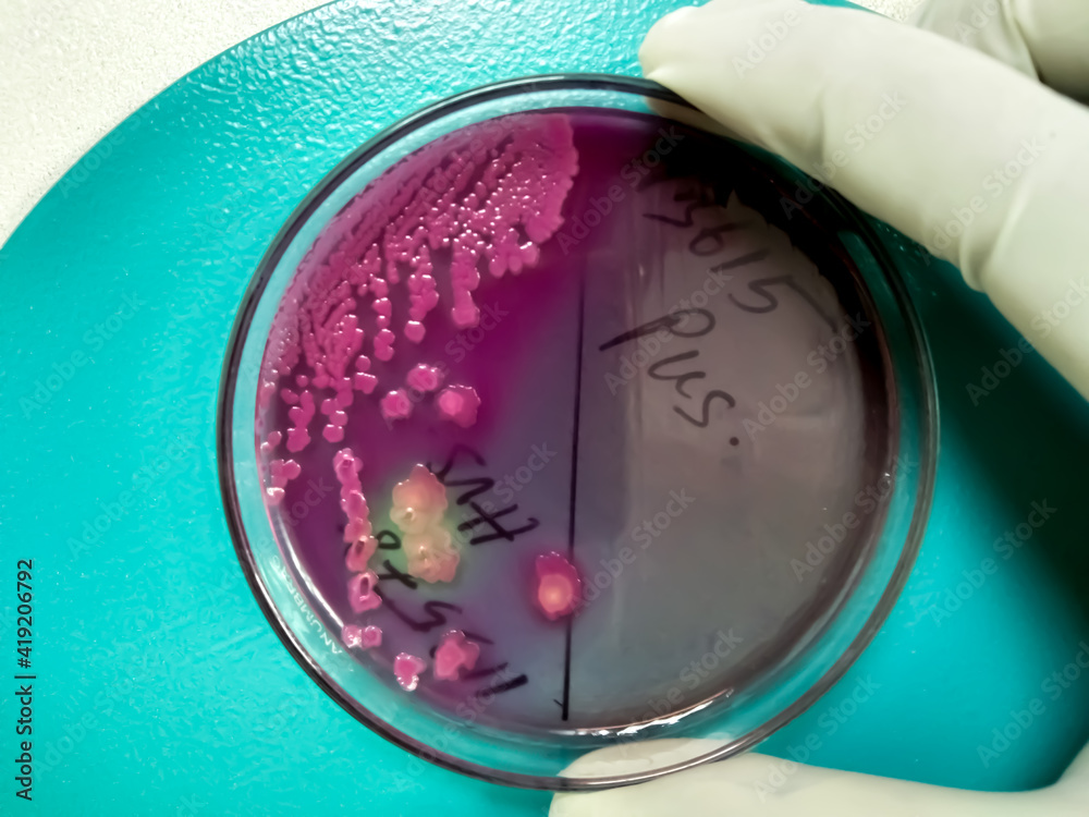 Colony Characteristics of Escherichia coli (E. coli) is a Gram-negative ...
