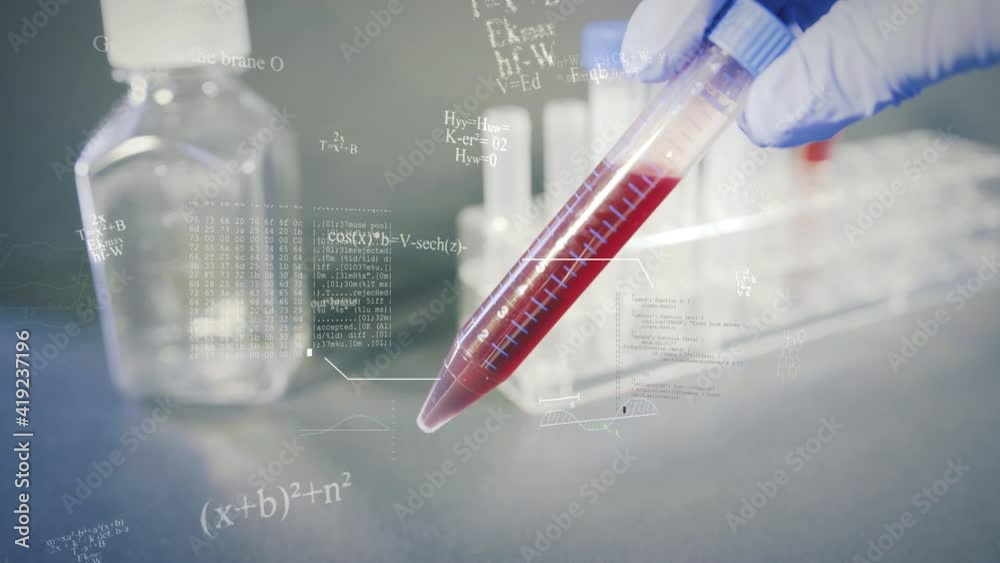 Digital formulas, equations, diagrams, evaluations next to blood sample ...