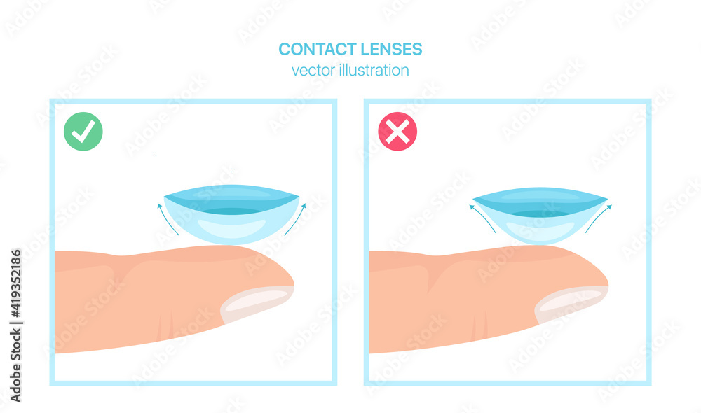 Vector guide how to put on contact eye lenses correctly. Right or wrong ...