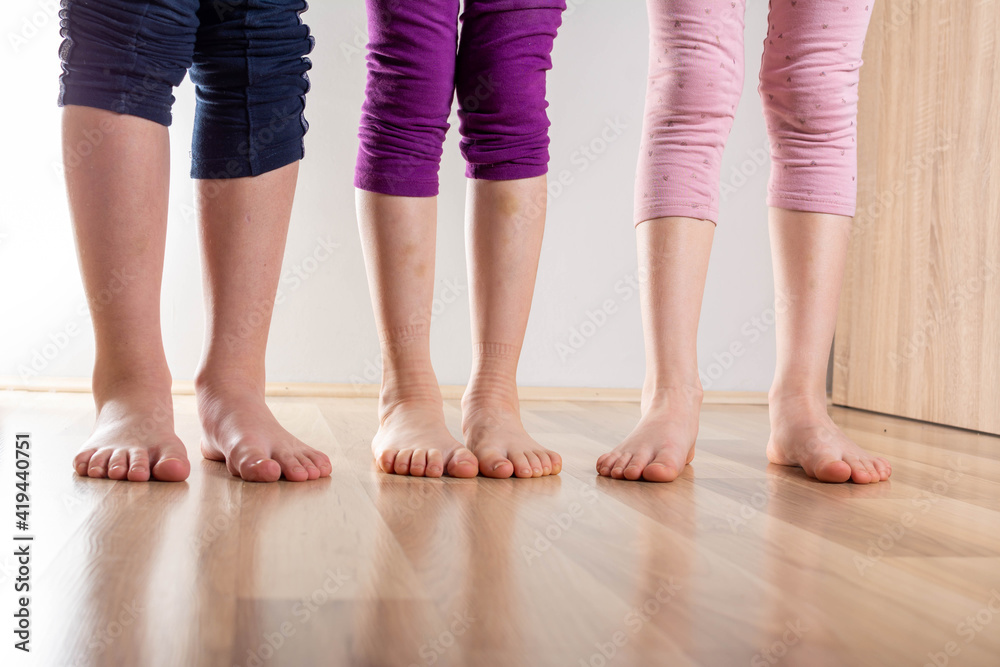 Cute kid leg, fast growing foot, isolated on wooden background. Defect ...