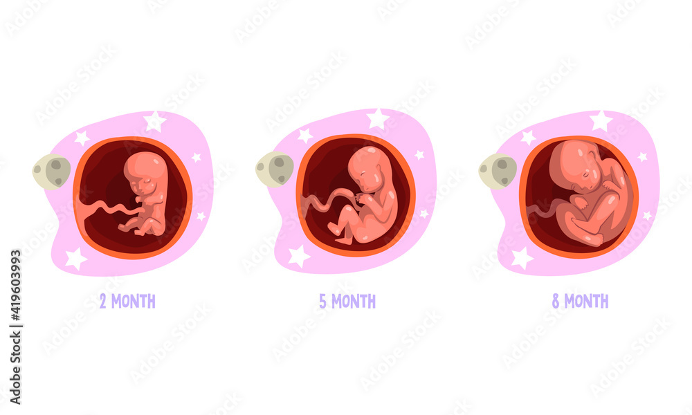 Stages of Embryo Development Set, 2, 5, 8 Month Cartoon Vector ...