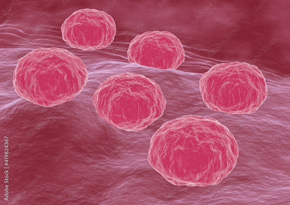 Chlamydia trachomatis is a sexually transmitted bacterium that causes ...