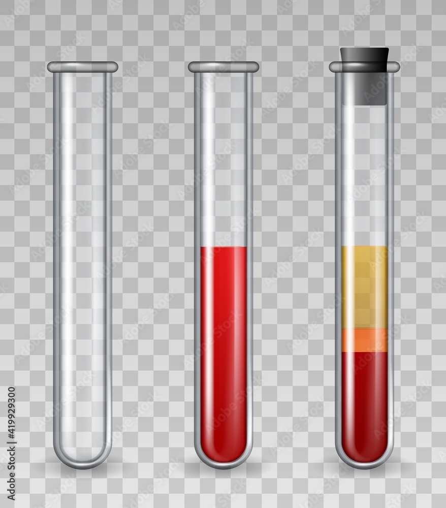 Test tubes with blood. Realistic glass medical tube empty, filled with ...