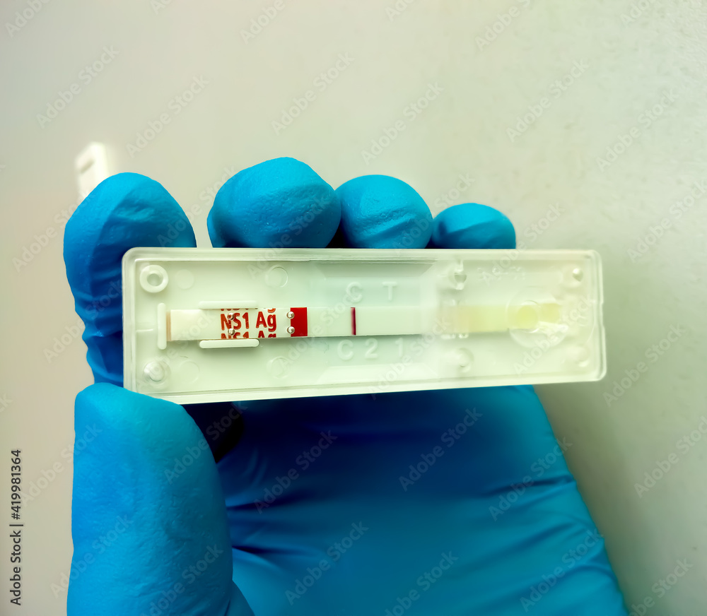 Technologist hand hold a device of Dengue Virus rapid screening test ...