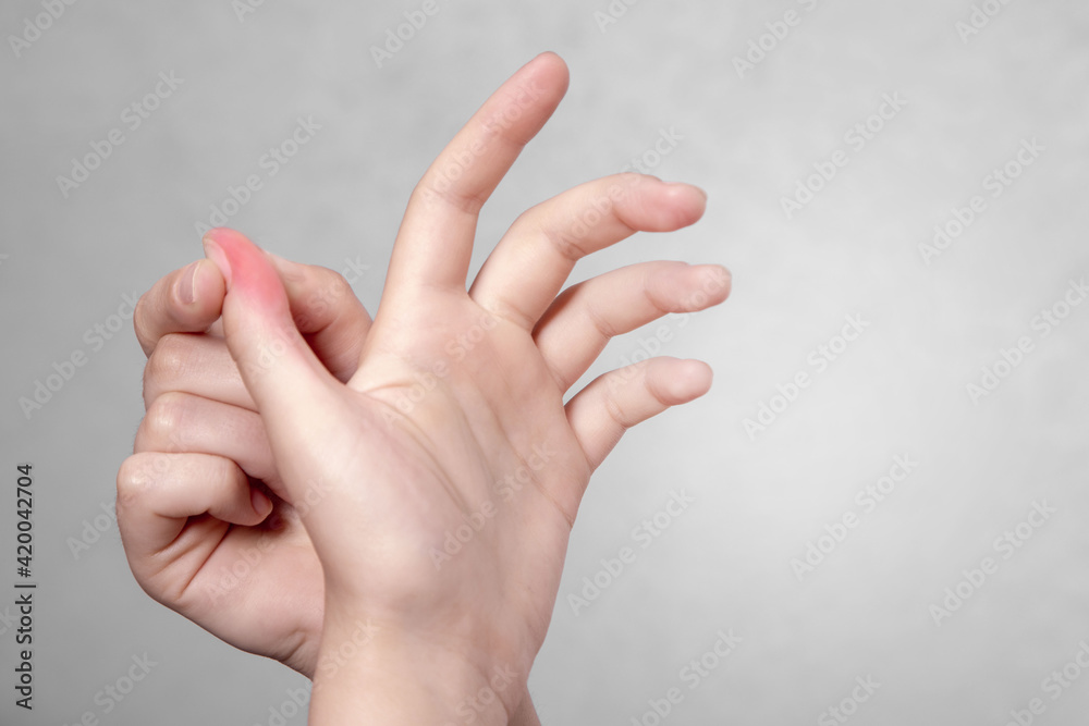 Finger pain. Medical and pharmaceutical concept. The woman is holding ...