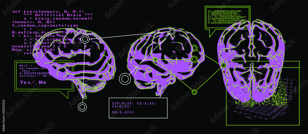 The human brain from the front and side view. MRI of CT scan. Stock ...