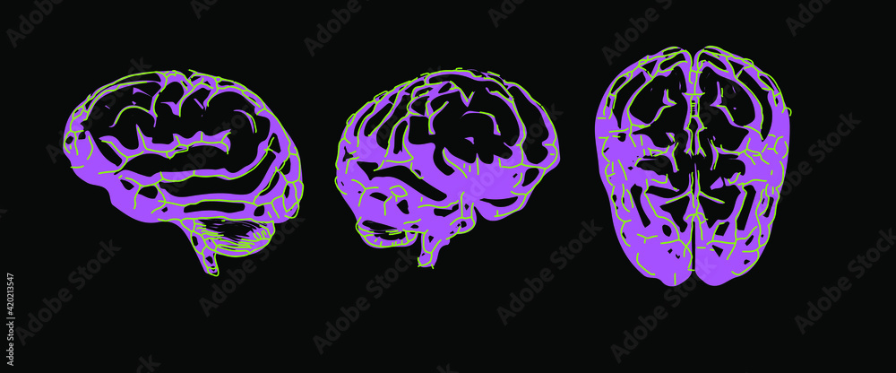 The human brain from the front and side view. MRI of CT scan. Stock ...