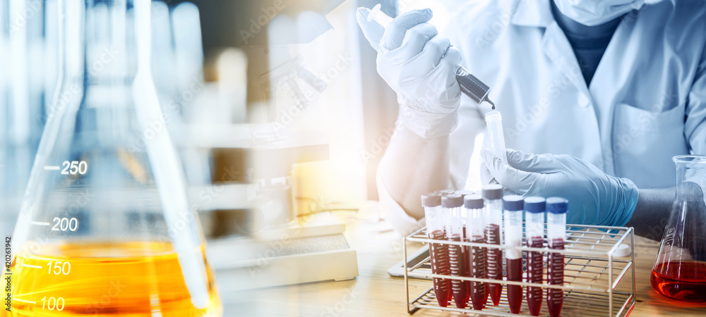 hand of scientist or doctor test blood sample with lab glassware and ...