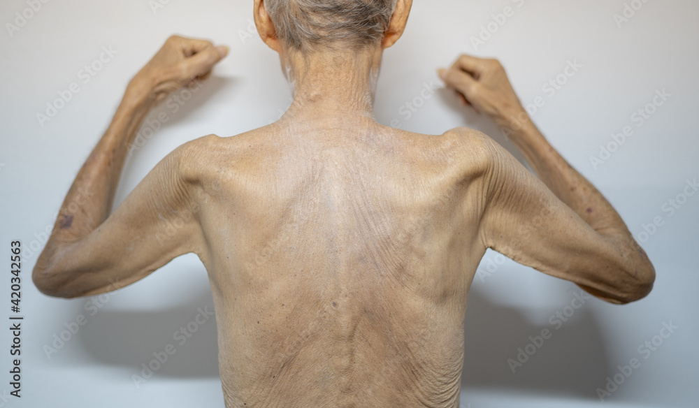 Foto de The thin old back man skin with close-up old skin with the ...
