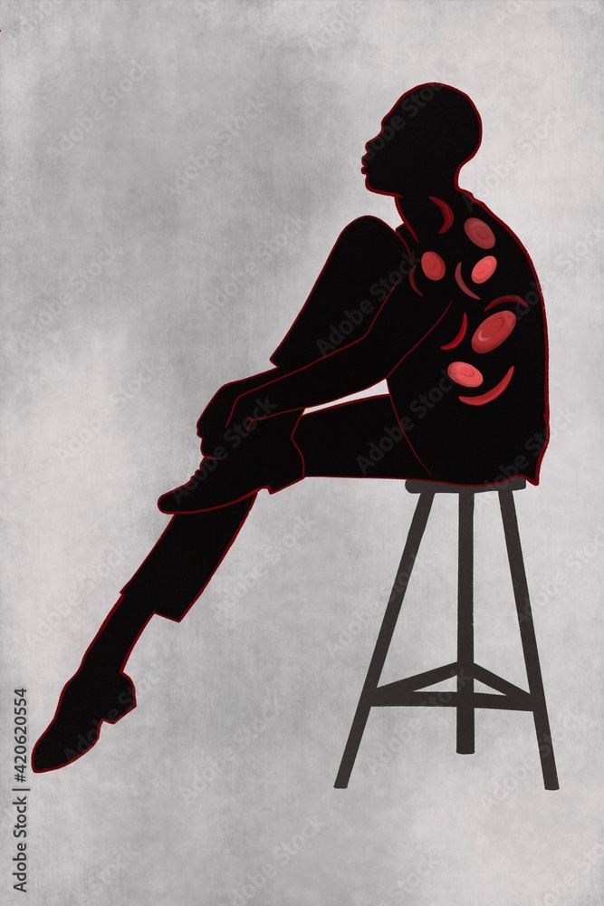 Sickle cell disease illustration. Stock Illustration | Adobe Stock