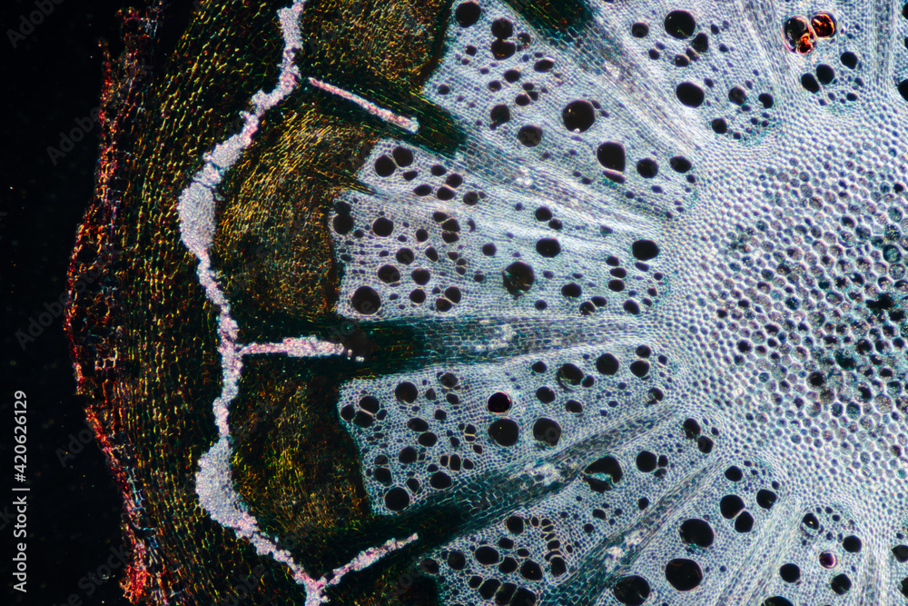 Micrograph of Caulis aristolochiae manshuriensis stem plant cell Stock ...
