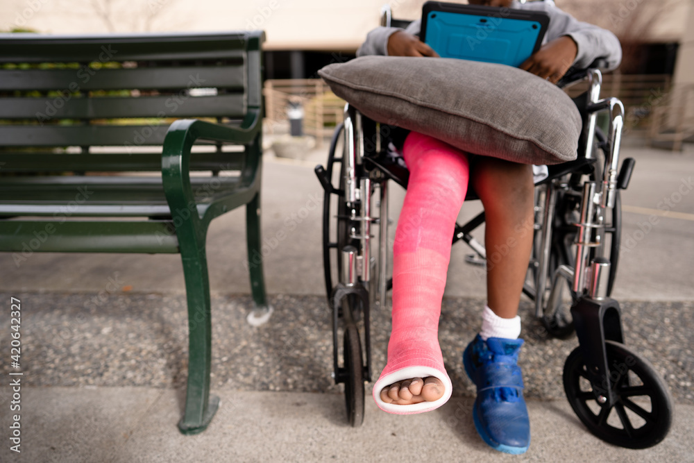 Faceless young person with broken leg sits in wheelchair Stock Photo ...