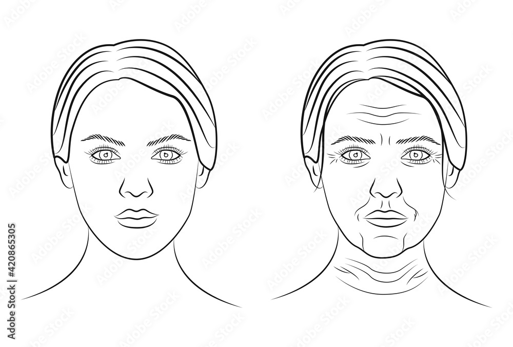 Anti-aging skin care. Different types of facial mimic wrinkles. Age ...