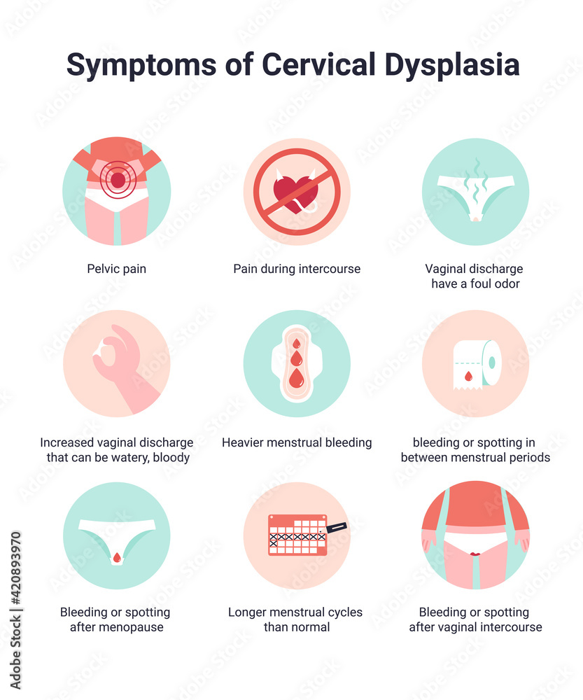Set Symptoms Of Cervical Dysplasia Icons Collection Flat Vector