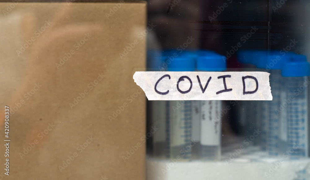 covid test tube rack pipette and fridge, for covid 19 coronavirus, test ...