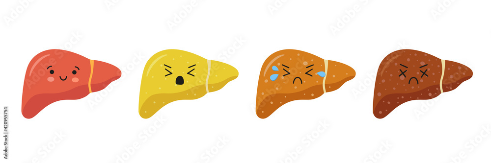 Stages human liver damage concept set. Healthy, fatty, fibrosis ...