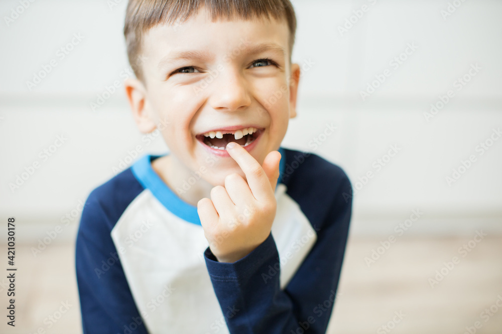 Little boy lost his first milk tooth. Stock Photo | Adobe Stock