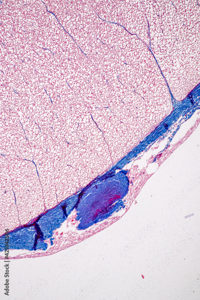 Education Spinal cord, Nerve, Cerebellum, Cortex and Motor Neuron Human ...