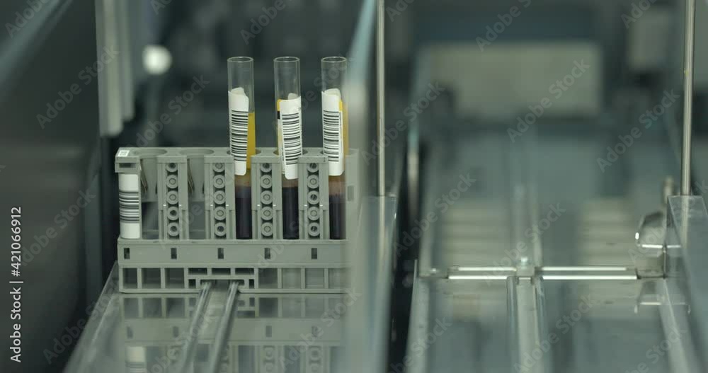 Automated analyzer in progress. Modern examination of biomaterial in ...