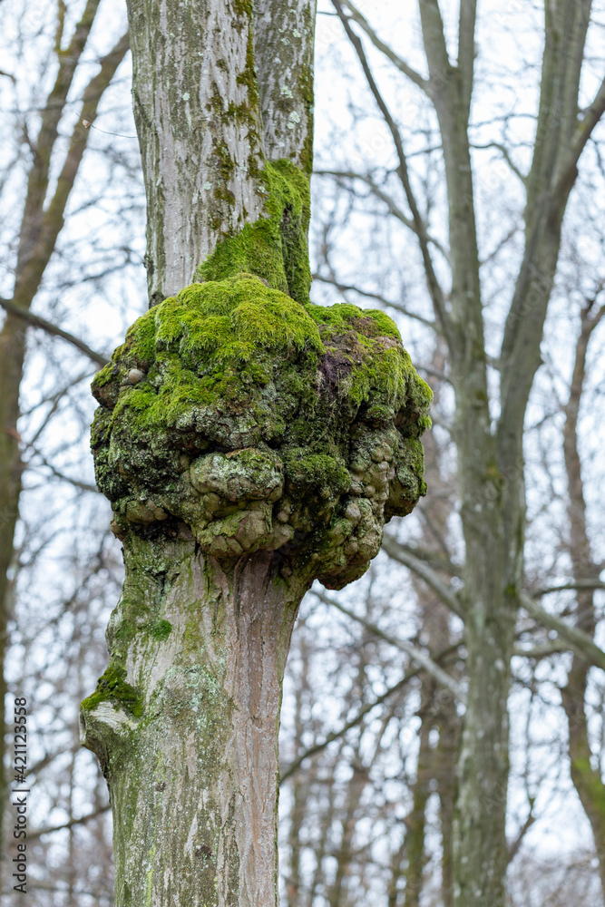 A tree burl caused by a parasitoid bacteria on a common hornbeam tree ...