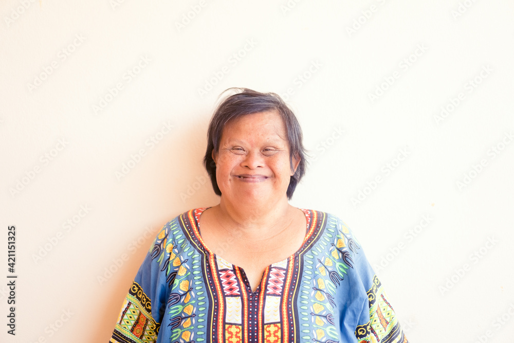 smiling asian down syndrome woman.Adult down syndrome.mentally disabled ...