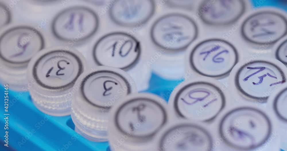 Close-up, a scientist puts a closed test tube in a laboratory case ...