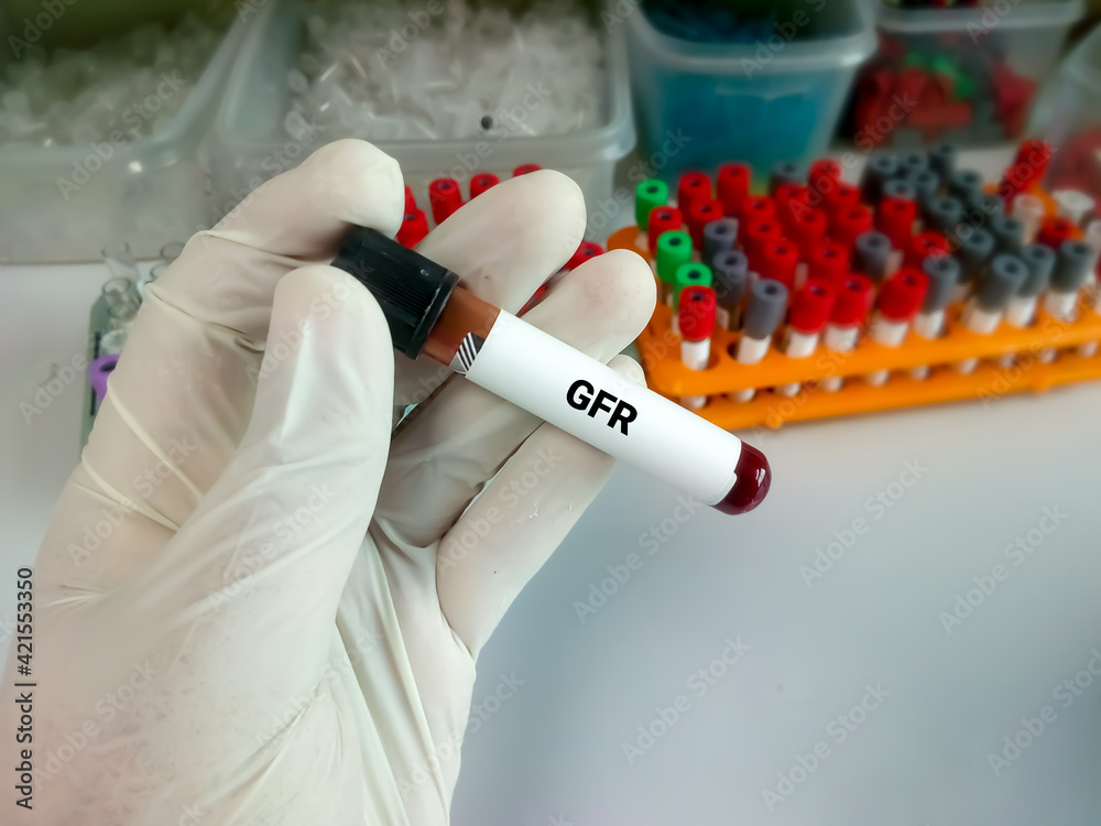 Blood sample for GFR, eGFR, Creatinine, Bun. Renal Function Test ...