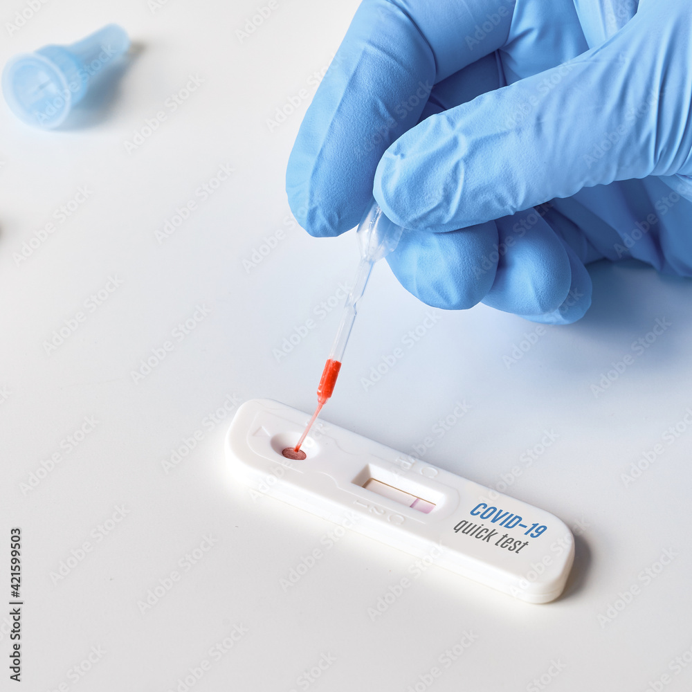 Rapid COVID-19 test for detection of specific antibodies IgM and IgG to ...