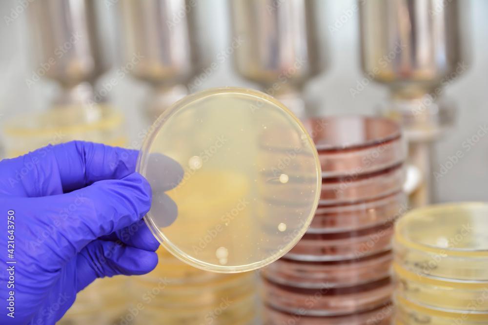 Colonies of bacteria in Petri dish. Microbiology Laboratory. Stock ...