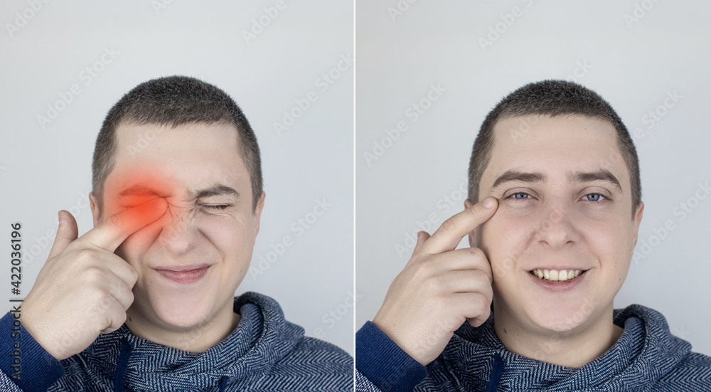 Before and after. On the left the man indicates eyes pain, and on the ...