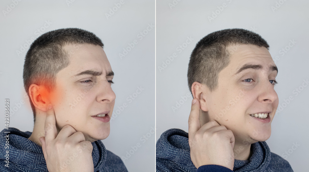 Before And After On The Left The Man Indicates Ear Pain And On The