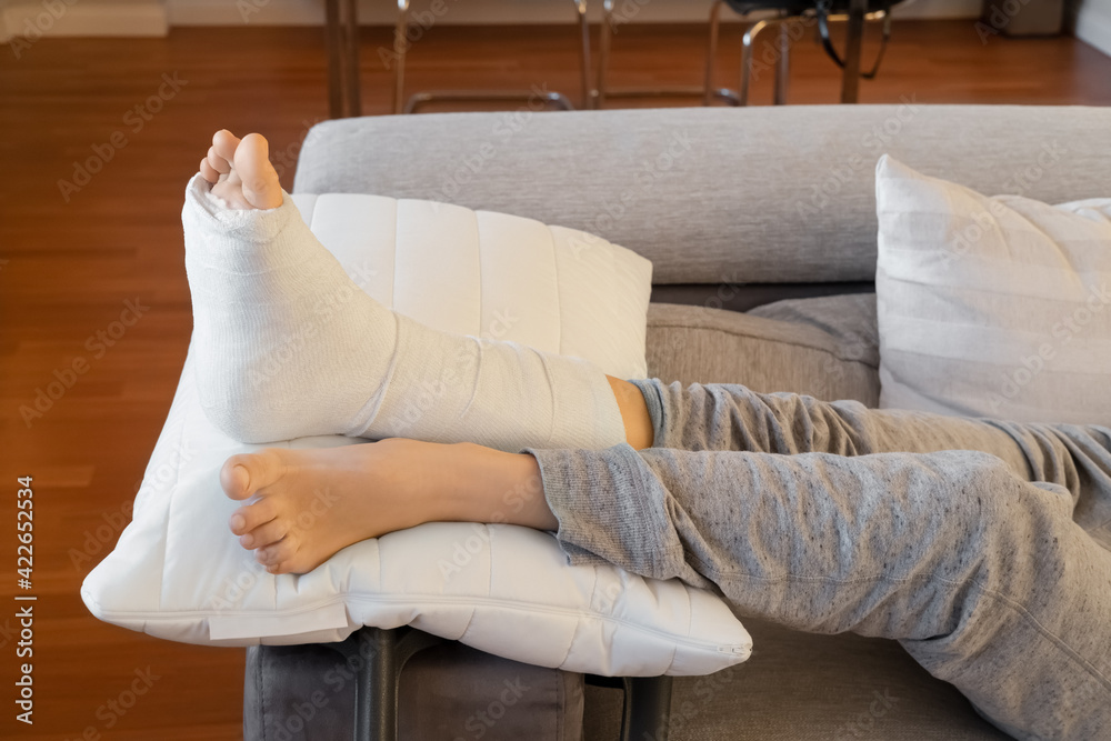 Female legs in orthopedic plaster on couch at home. Fracture of the leg ...