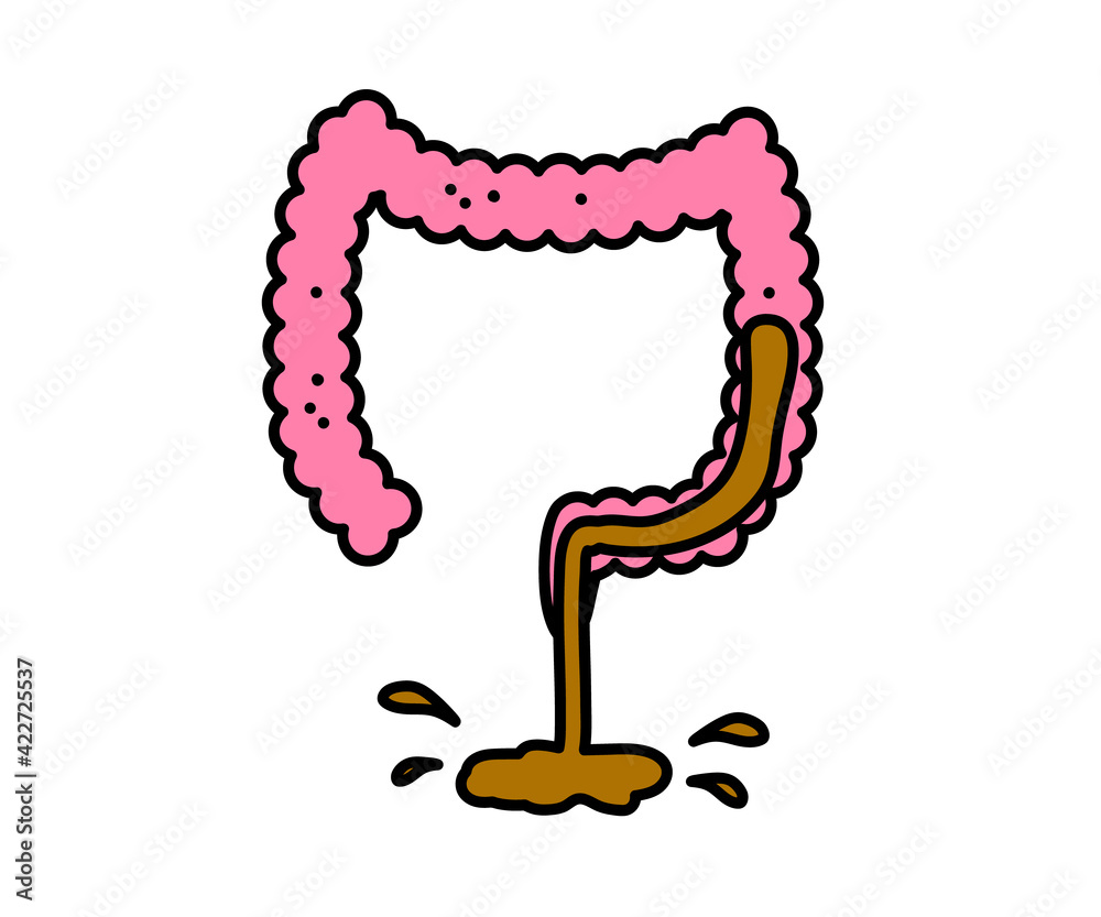 Large intestine on a white background. Diarrhea. Vector illustration ...