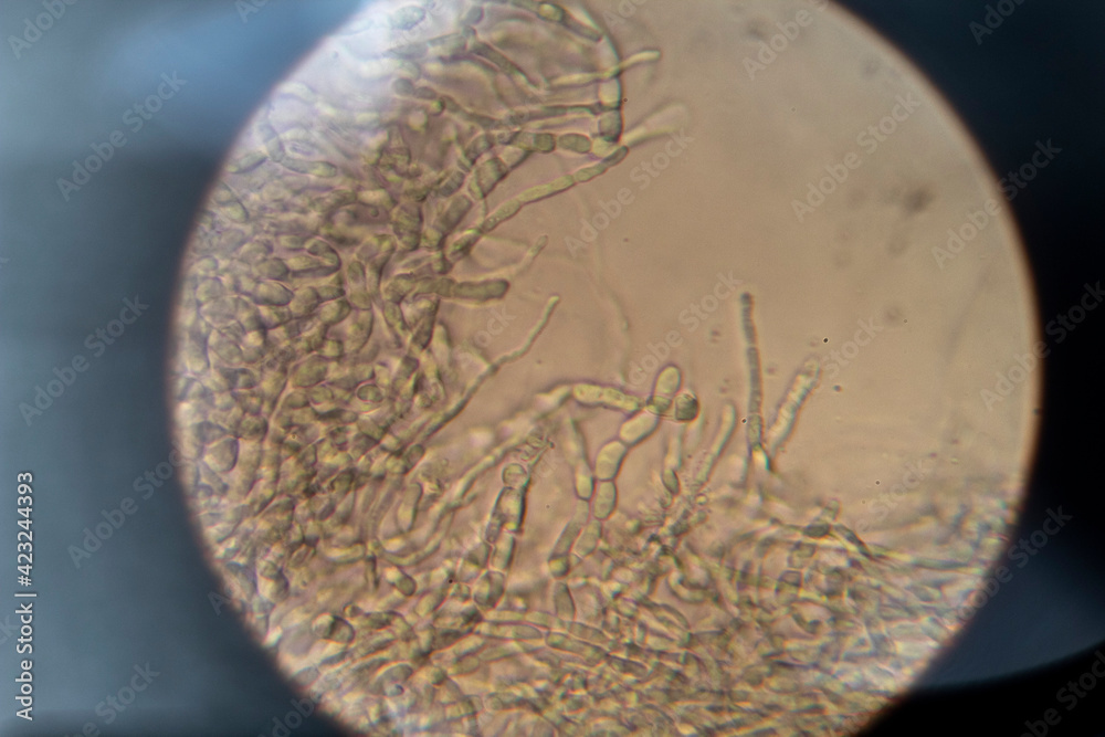 hongo visto a través del microscopio Stock Photo | Adobe Stock